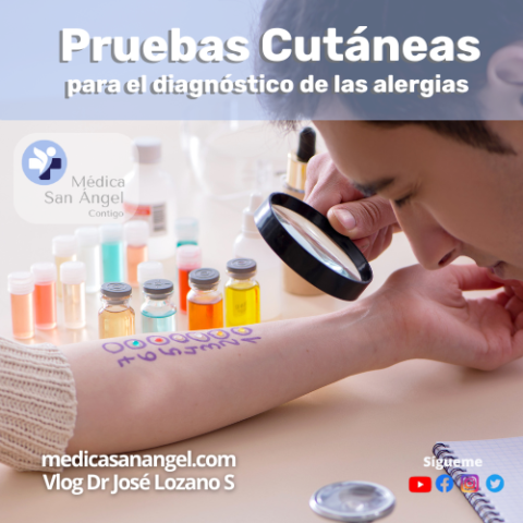 Qué son las Pruebas Cutáneas y para qué sirven | Médica San Ángel 📞 ...